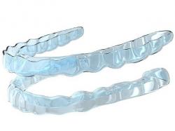 dental resin to glue essix retainer plastic 3D Models | Page 1 | STLFinder