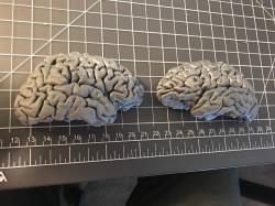 balancing the brain hemispheres 3D Models | Page 1 | STLFinder
