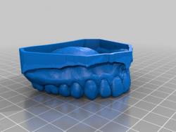 dental 3D Models | Page 1 | STLFinder