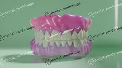 trueness and fitting accuracy of maxillary 3d printed complete dentures ...