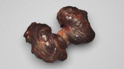 40x microscope view image of human thyroid gland labeled 3D Models ...