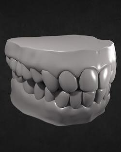 solidworks cad teeth and gums 3D Models | Page 1 | STLFinder