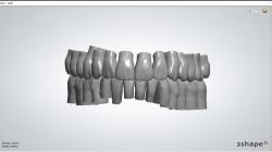 tooth library 3D Models | Page 1 | STLFinder