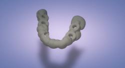 dental implant surgical guide fabrication 3D Models | Page 1 | STLFinder