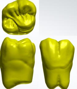 maxillary first molars 3D Models | Page 1 | STLFinder