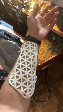 over arm blade guard for unisaw 3D Models | Page 1 | STLFinder