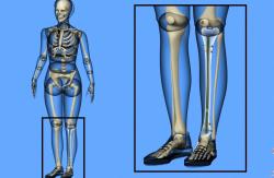 tibial intramedullary nail 3D Models | Page 1 | STLFinder