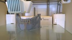 3d printed medical implants | Page 1 | STLFinder