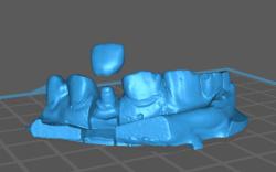 anatomical crown 3D Models | Page 1 | STLFinder