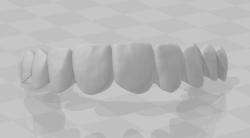 cyraxx teeth 3D Models | Page 1 | STLFinder