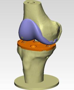 prosthetic knee joint 3D Models | Page 1 | STLFinder
