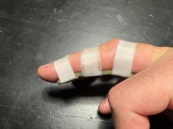 finger splint 3D Models | Page 1 | STLFinder