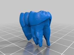 multiple tooth extractions for dentures 3D Models | Page 1 | STLFinder