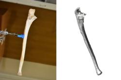 forearm bone anatomy 3D Models | Page 1 | STLFinder