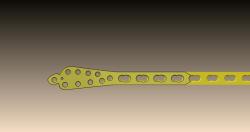lcp distal femur plates with liss instrumentation stl file 3D Models ...