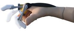 3d printed prosthetic finger | Page 1 | STLFinder