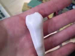 tooth in a tooth 3D Models | Page 1 | STLFinder
