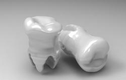 teeth molar 3d models | Page 1 | STLFinder