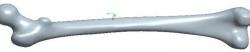 femur 3d model download | Page 1 | STLFinder