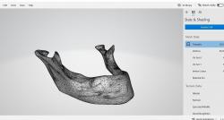 mandible cad model | Page 1 | STLFinder